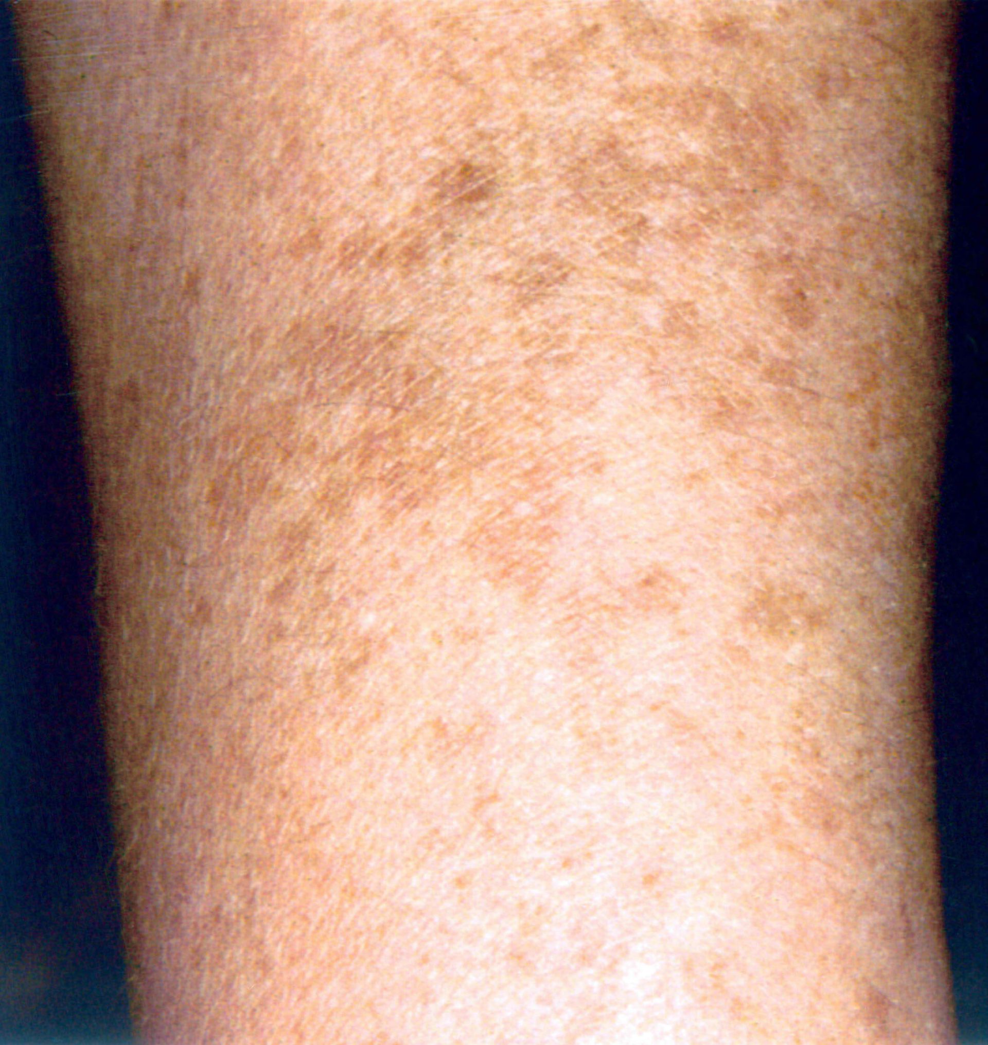 Results The Aesthetic Lounge results-the-aesthetic-lounge